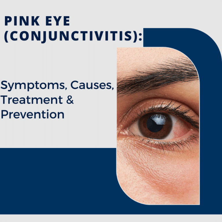 Pink Eye (Conjunctivitis): Symptoms, Causes, Treatment, & Prevention ...
